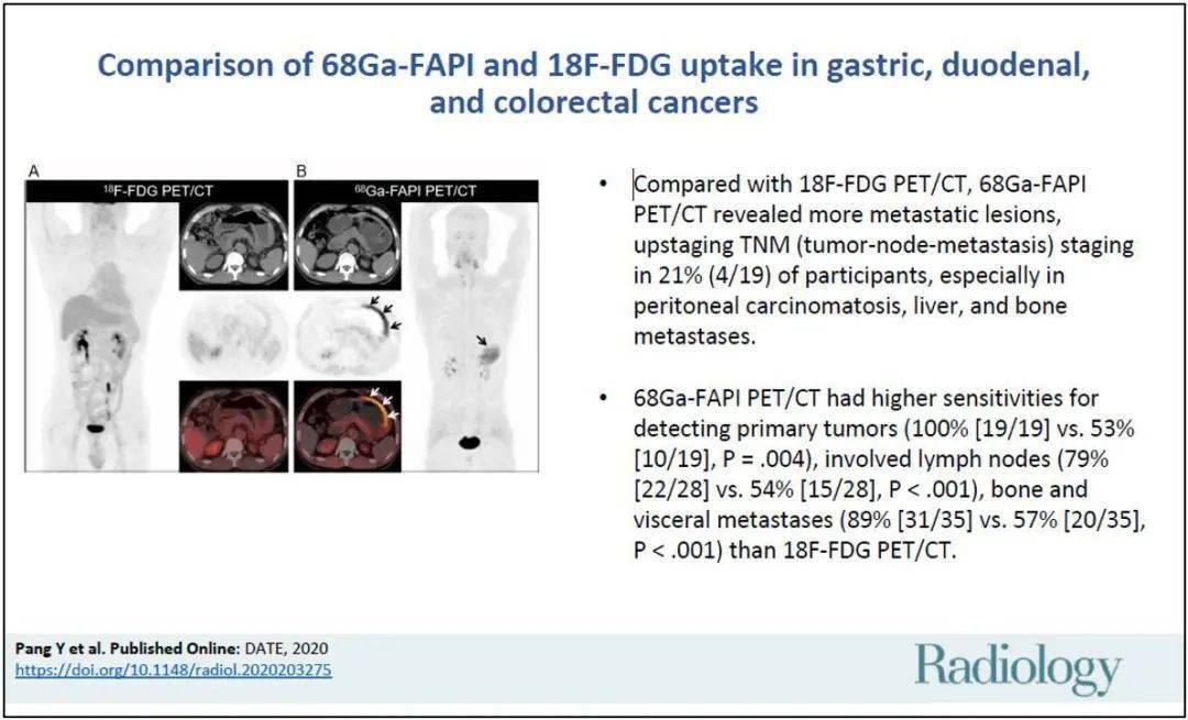【学术】厦大一院核医学科荣登Radiology | PET示踪剂68Ga-FAPI_肿瘤