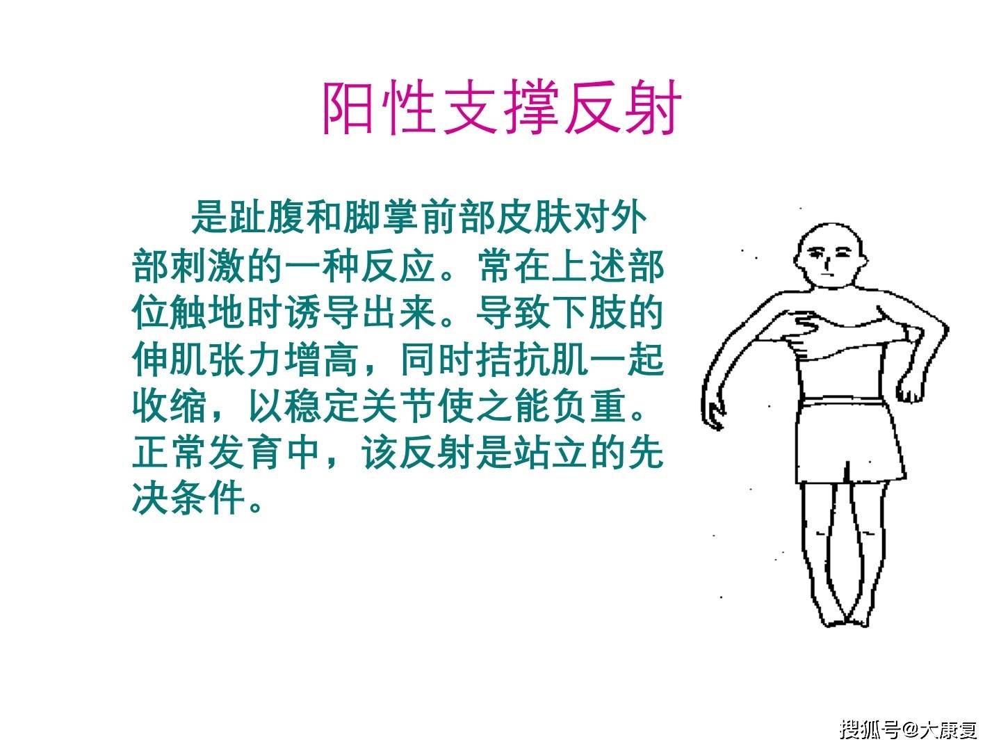 Brunnstrom技术_运动