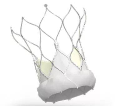 填补市场！雅培Navitor TAVR 系统获CE 认证-中国网