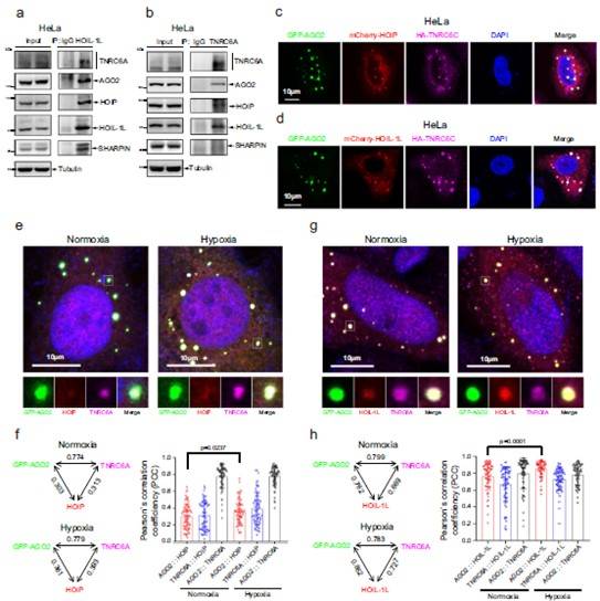 RIP-seq项目文章|nature子刊揭示低氧诱导AGO2线性泛素化调控肿瘤发生发展机制_研究