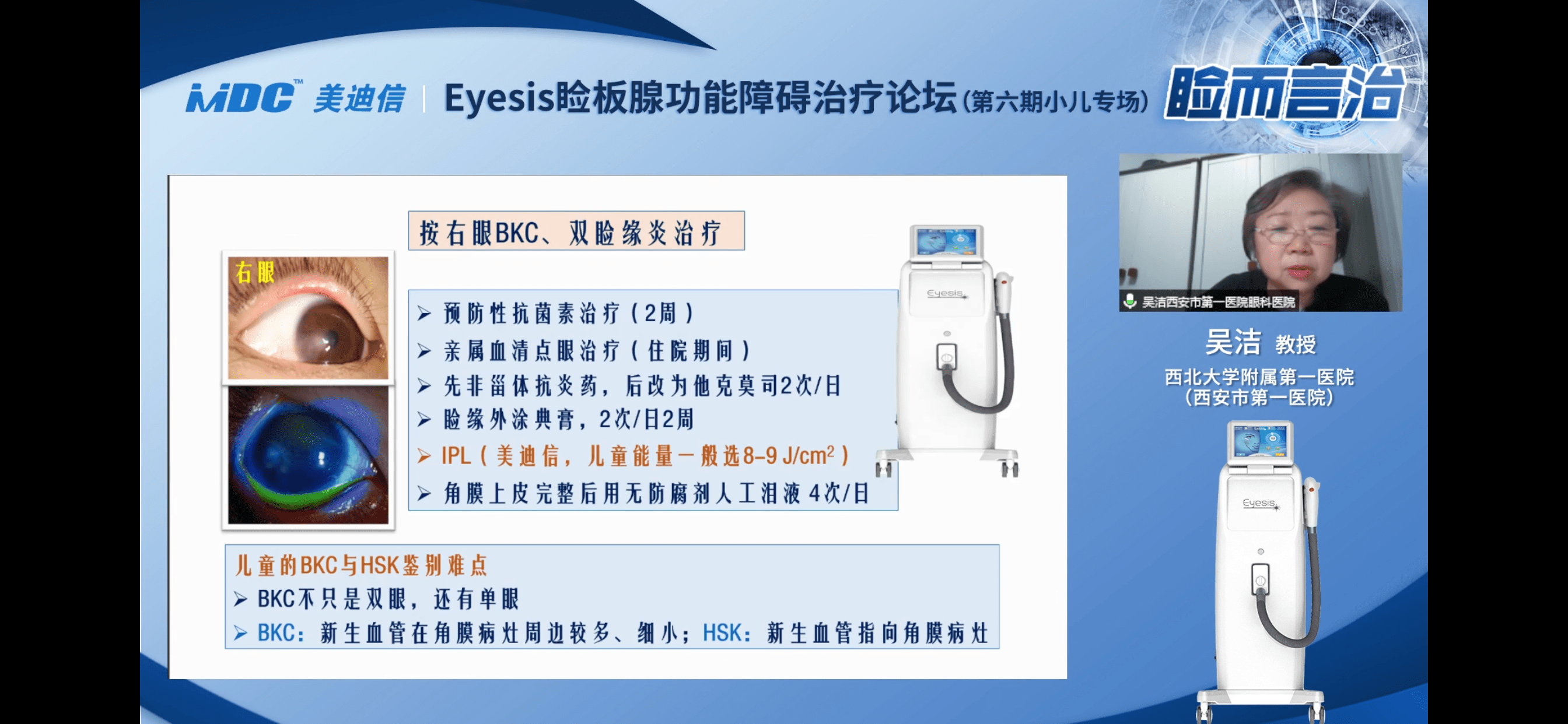 强脉冲光IPL治疗干眼的效果行不行？有没有副作用？_Eyesis