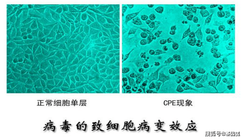 经验分享：病毒半数组织感染量（TCID50）简介_细胞_进行_统计原理