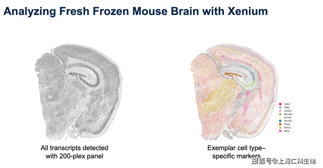 空间生物学的下一个热点—组织原位多组学分析！_Xenium_检测_蛋白