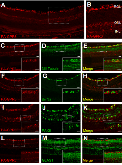 NEPA21——视网膜神经节细胞中GPR3的表达有助于神经元存活并加速轴突再生_研究_视神经_作用