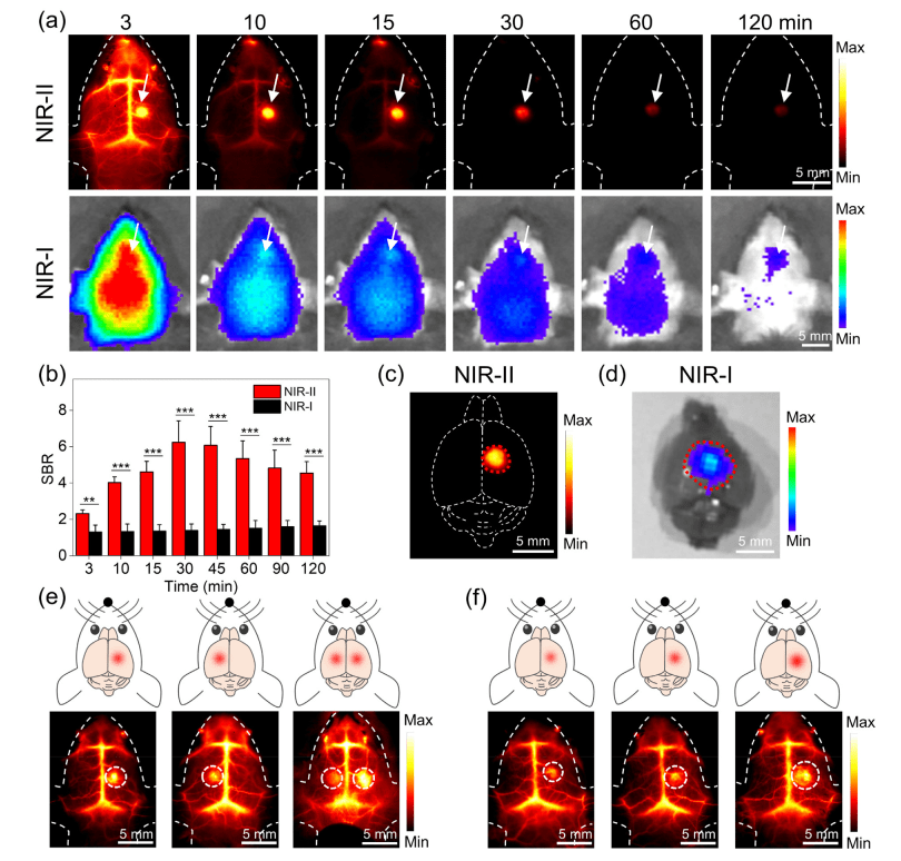 超声诱导血脑屏障开放的NIR-II荧光显像用于ICG微泡增强光热治疗胶质母细胞瘤_成像_方法_监测