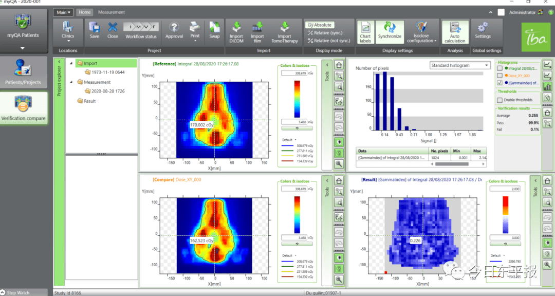 东平县人民医院引进德国IBA MatriXX调强验证系统_放疗