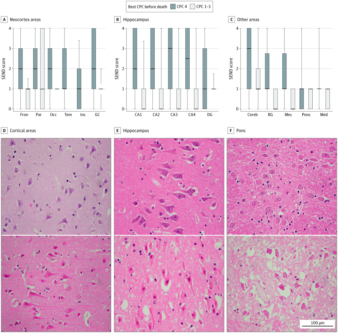 JAMA Neurol这项研究真绝！_Brain