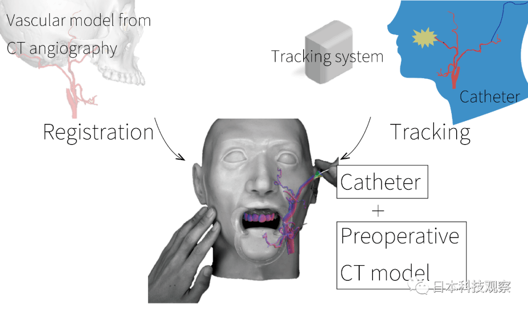 外科手术导航系统基础研究介绍_辅助