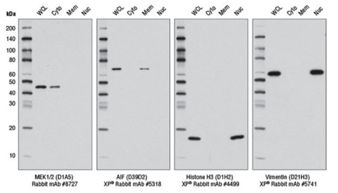 做 WB 你最容易忽略的几个细节，我们找出来了_细胞