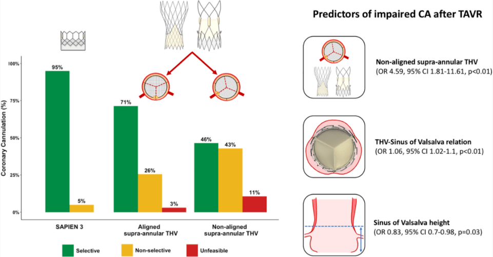 探索 | TAVR术中确保瓣膜对合缘对齐更有助于保障冠脉通路_患者_Acurate_Neo