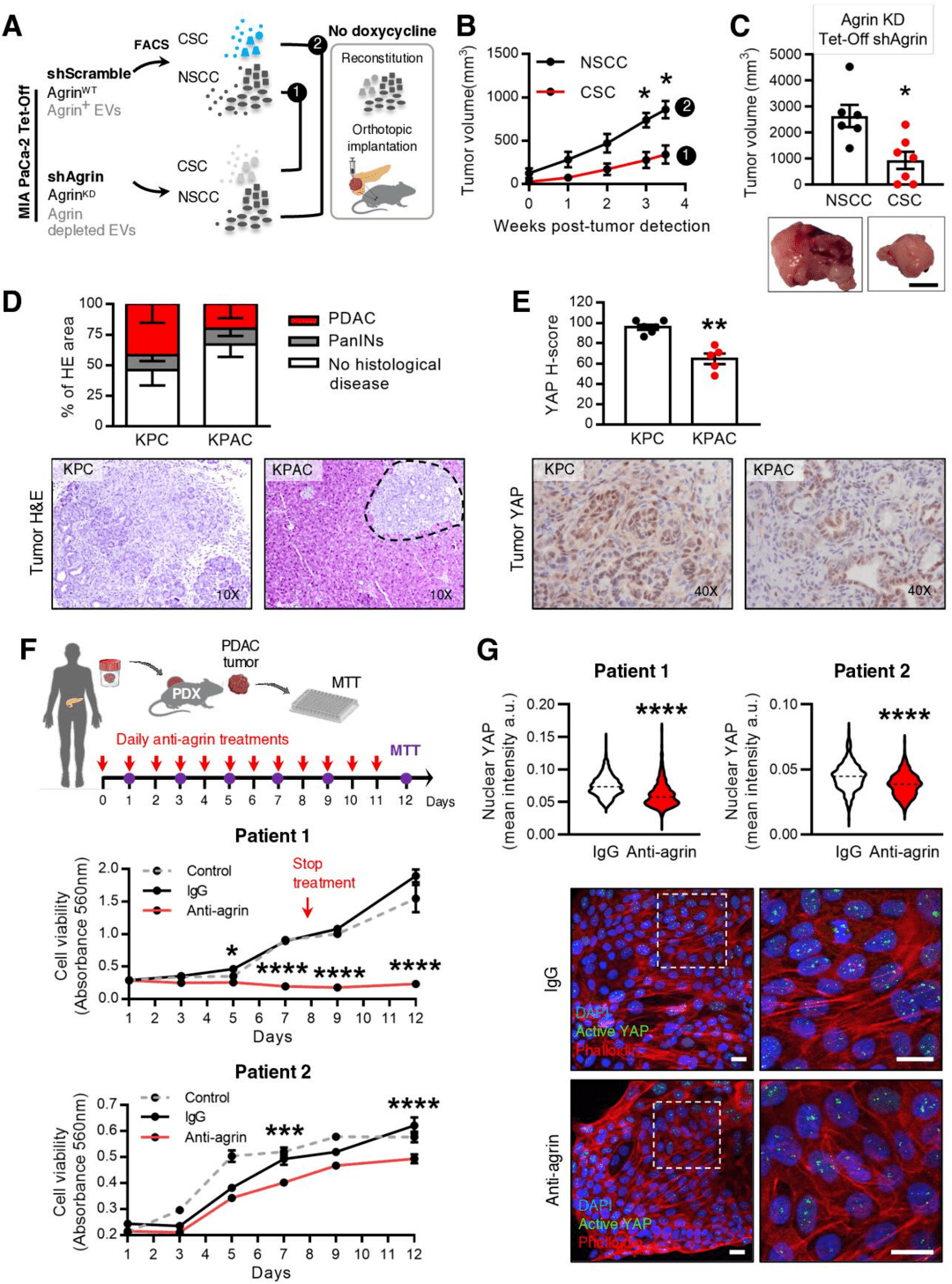 Gut（IF 23.059）| 癌细胞的密探007！胰腺癌细胞外泌体构建信号网络促进肿瘤进展_研究_Network_通讯