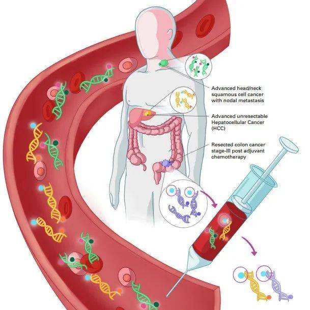 案例报道丨多原发恶性肿瘤中tumor-informed与tumor-agnostic的ctDNA-MRD对比分析！_检测_进行_Reveal