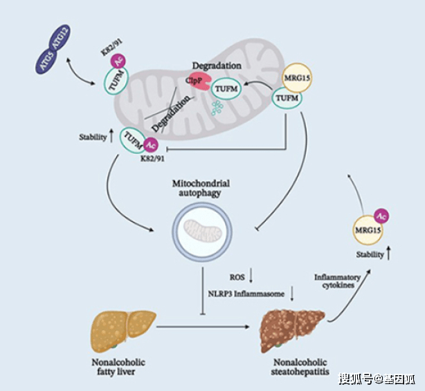 学术前沿：我国科研团队发现治疗非酒精性脂肪肝炎新靶点_肝脏_发展_炎症
