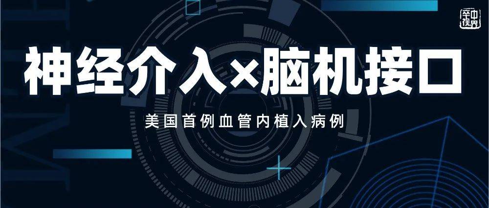 环球神介丨血管内植入脑机接口设备Stentrode完成美国首例临床应用_Majidi_患者_神经