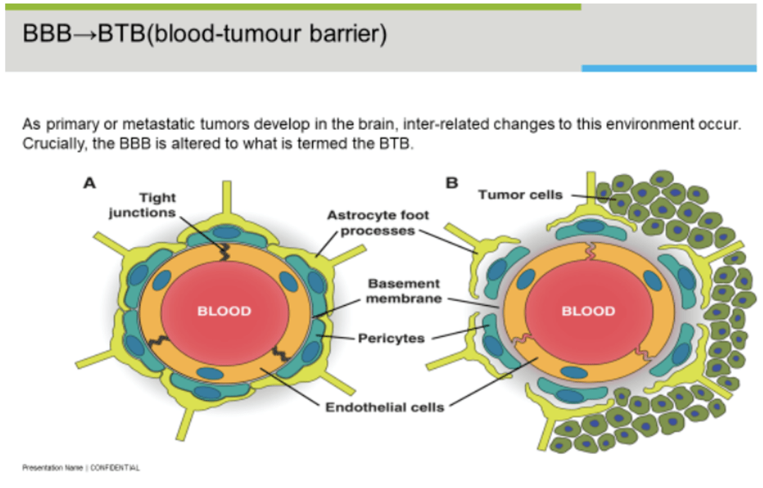 廖宁教授深度解读新一代ADC T-DXd破局HER2阳性乳腺癌脑转移_研究_患者_治疗
