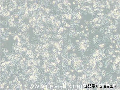 细胞学堂 | SK-BR-3总是漂怎么办_处理_漂浮物_贴壁