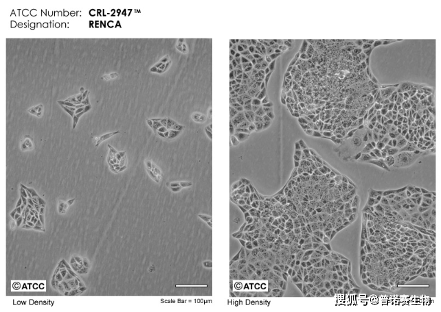 细胞学堂 | 为何Renca细胞形态异常_血清_培养基_调整