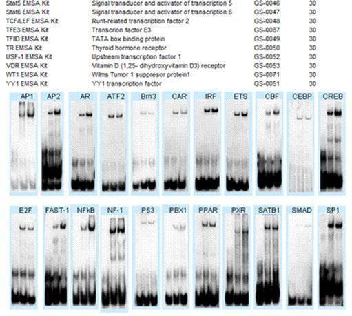 一文搞定凝胶迁移实验（EMSA）_探针_标记_反应