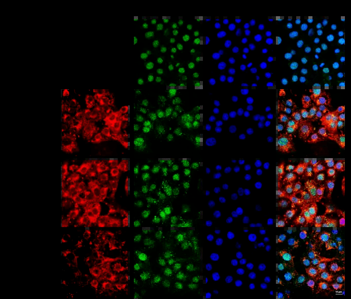 iScience|曹永长教授团队发现SADS-CoV通过细胞自噬促进自身繁殖_Akt_增殖_通路