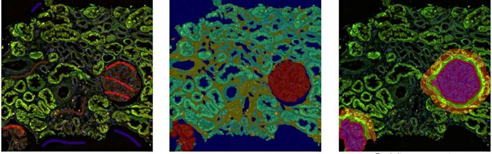 多组学数据标准的验证利器分享——TissueFAXS Cytometry技术_组织_研究_细胞