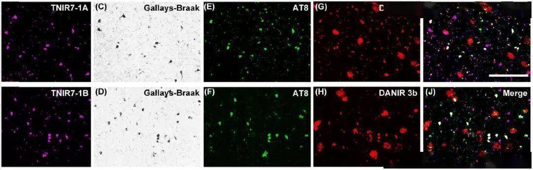 11.11 脑科学日报｜Science：脑细胞基因新疗法可治疗神经系统疾病_研究_皮层_神经元