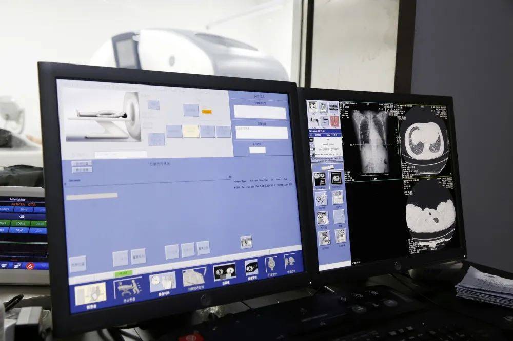 疾病诊断又添“侦察兵”！Optima CT620上线-搜狐大视野-搜狐新闻