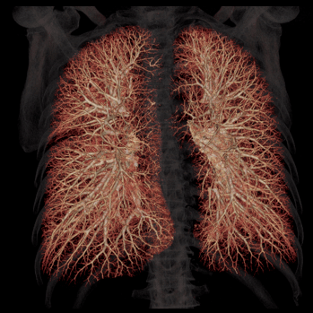 疾病诊断又添“侦察兵”！Optima CT620上线-搜狐大视野-搜狐新闻
