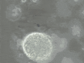 显微镜下动图：细胞是如何工作的？_细菌_过程_攻击